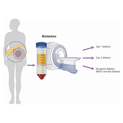 Biomarkers and Function of the β Cell in Diabetes | Endocrine Society