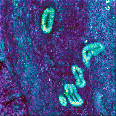 Chronic Estrus Disrupts Endometrial Glands | Endocrine Society