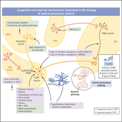 Etiology Of Central Precocious Puberty Endocrine Society