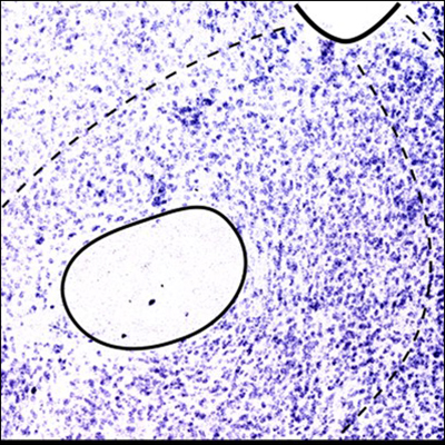 GHSR in a Subset of GABA Neurons Controls Food Deprivation-Induced ...