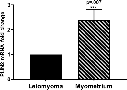 PLIN2 Functions As a Novel Link Between Progesterone Signaling and ...