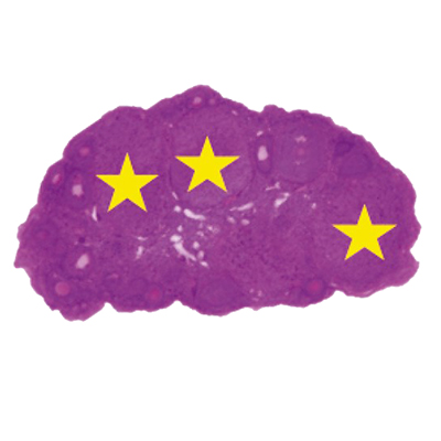 Pathogenesis of PCOS in a Mouse Model | Endocrine Society