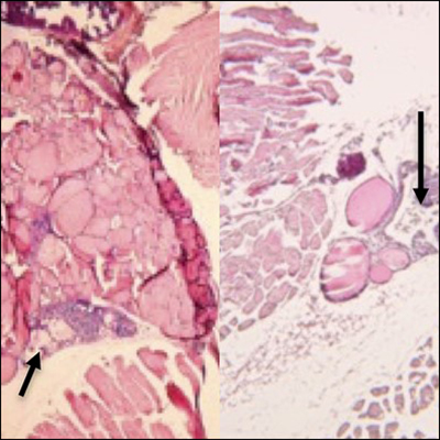 Phenotype of Parathyroid-targeted Cdc73 Deletion in Mice Is Strain ...