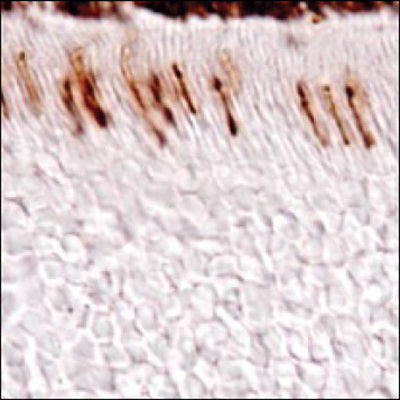 Thrb Enhancer Mutations | Endocrine Society